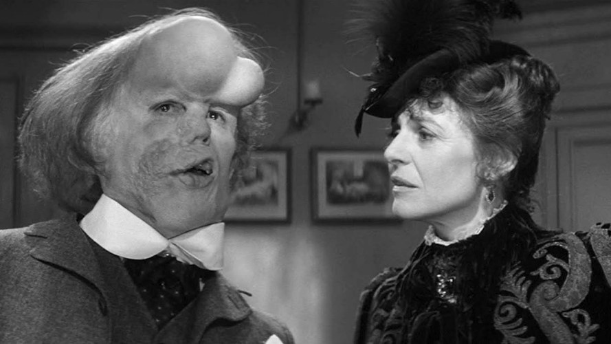The Elephant Man in 4K UHD, la recensione: uno sguardo ancora più ...