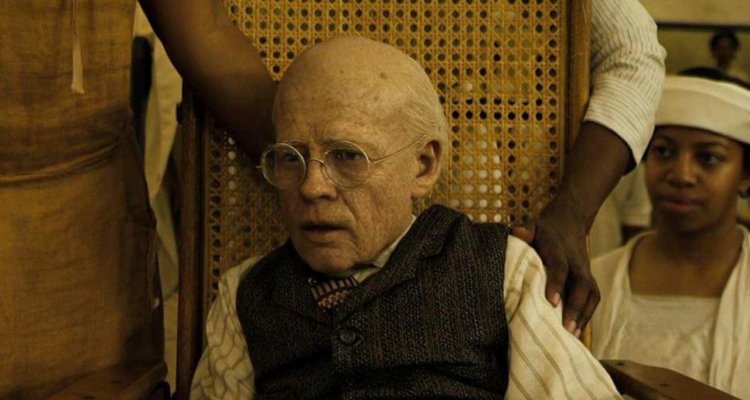 Il curioso caso di Benjamin Button: la malattia che ha ispirato il look ...