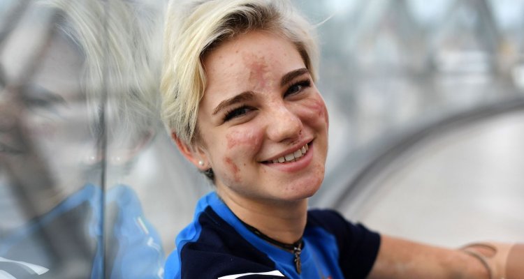 Bebe Vio, la malattia e l'amputazione a 11 anni - Movieplayer.it