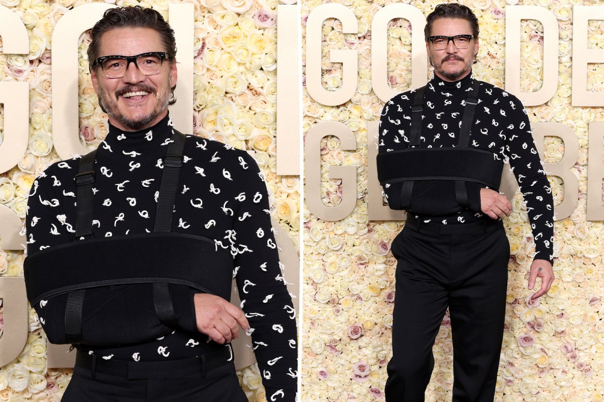 Pedro Pascal, come si è rotto il braccio e lo scherzo non riuscito a ...
